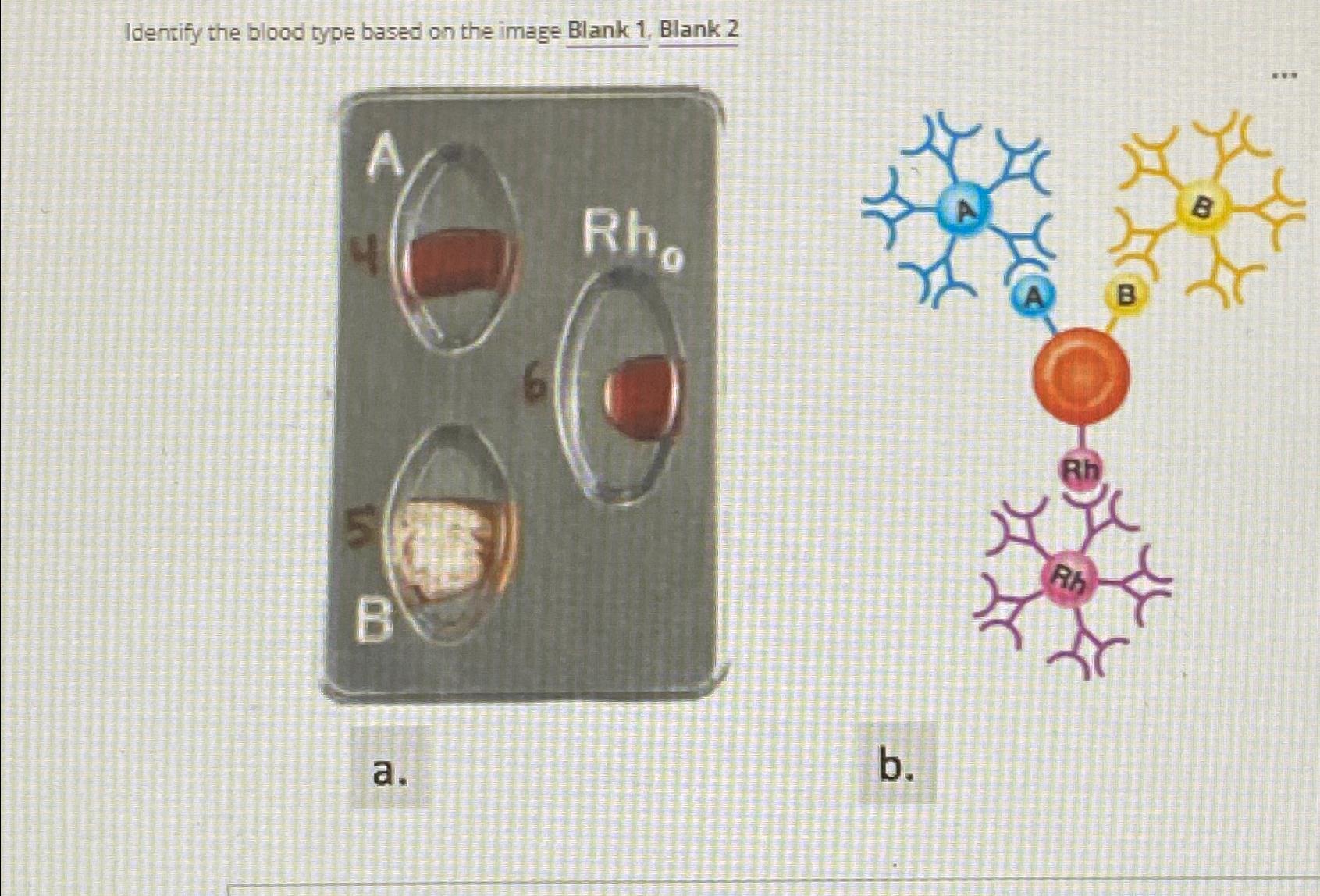 Solved Identify the blood type based on the image Blank | Chegg.com