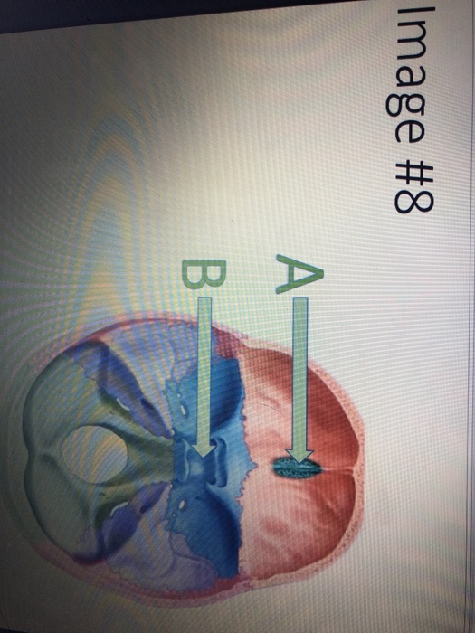 Solved Use the images to identify the bones and the bony | Chegg.com