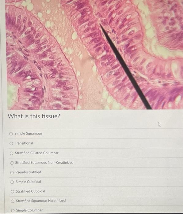 Solved What is this tissue? Simple Cuboidal Stratified | Chegg.com