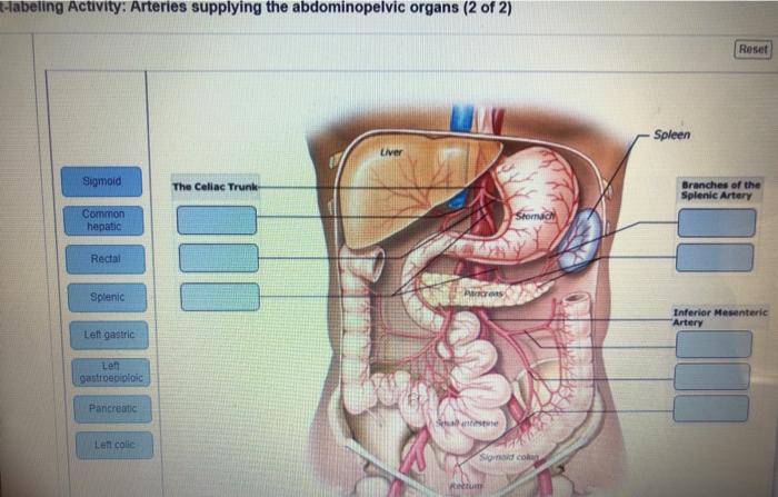 Solved -labeling Activity: Arteries supplying the | Chegg.com
