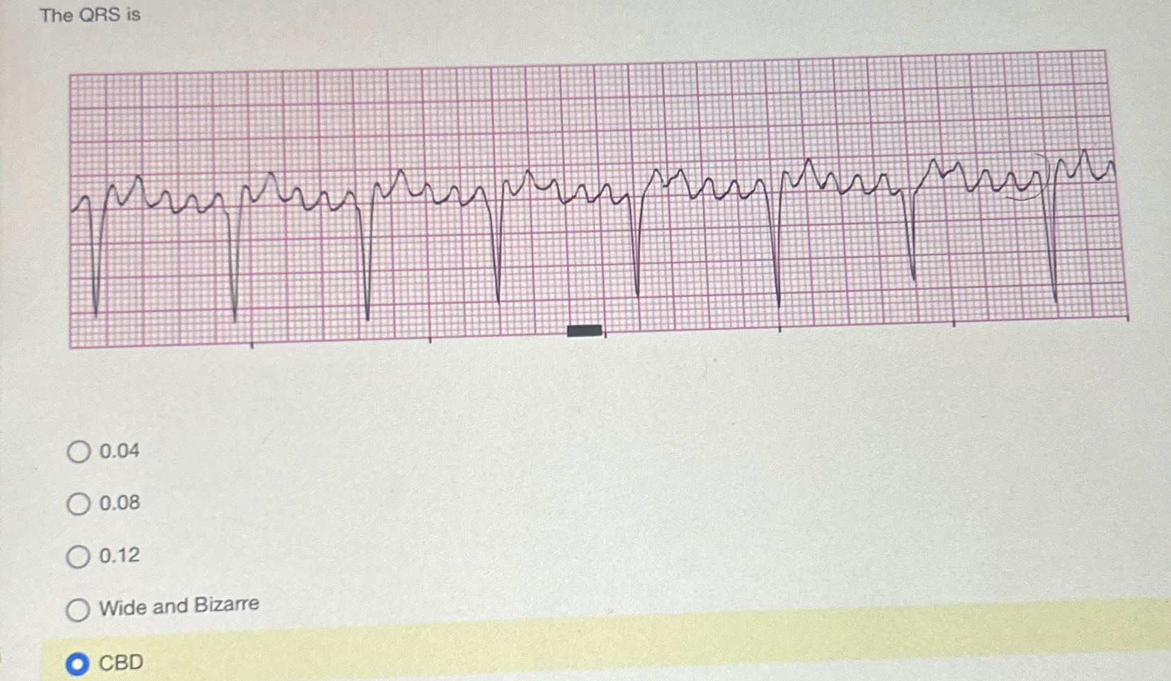 Solved The QRS is0.040.080.12Wide and BizarreCBD | Chegg.com