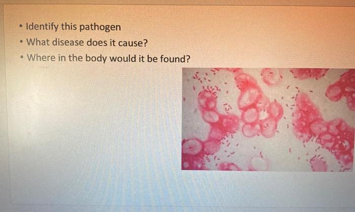 Solved Identify this test. Which tube shows a positive | Chegg.com