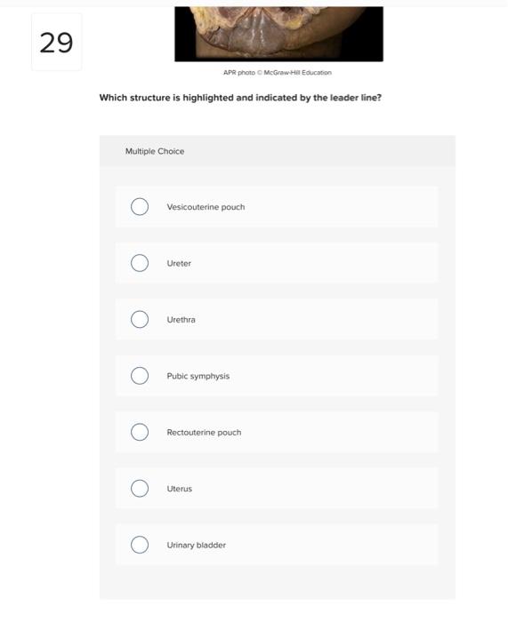 Which structure is highliahted? Multiple Choice | Chegg.com