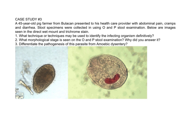 CASE STUDY #1 A 34-year-old male presents to the | Chegg.com