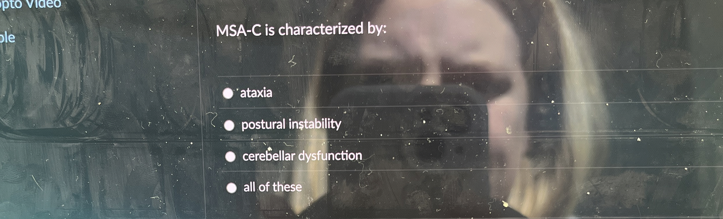 Solved MSA-C is characterized by:ataxiapostural | Chegg.com