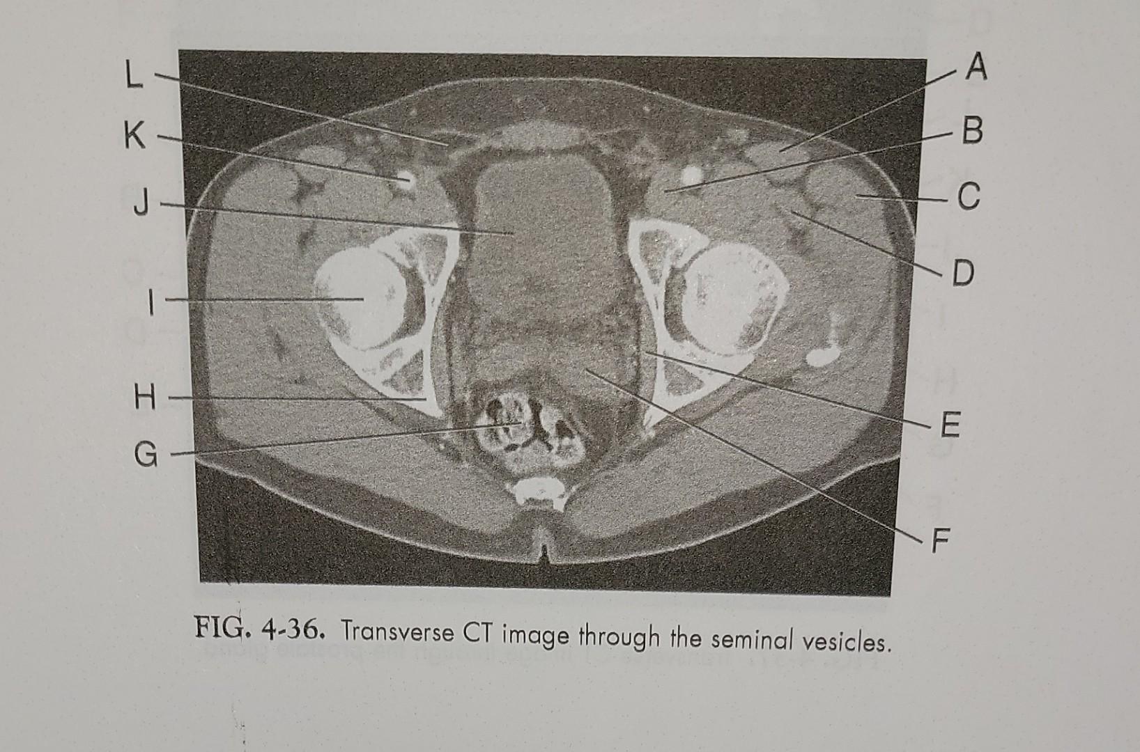 Solved FIG. 4-32. Transverse CT image through the | Chegg.com