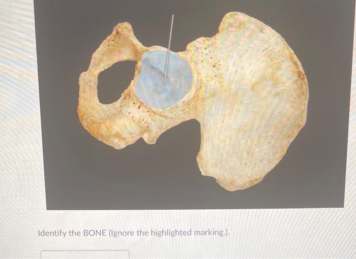 Solved Identify the BONE (Ignore the highlighted marking.) | Chegg.com