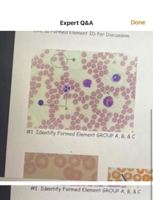 Solved LA2 la Formed Element ID for Discussion BC . #2 | Chegg.com