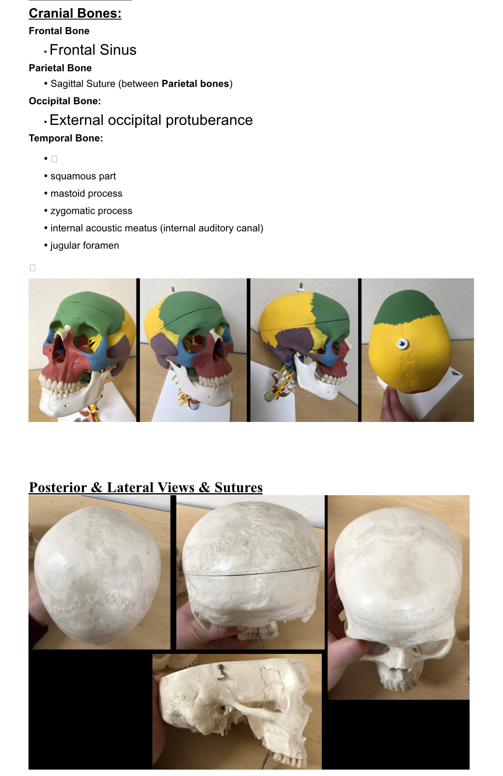 Cranial Bones:Frontal Bone-Frontal SinusParietal | Chegg.com