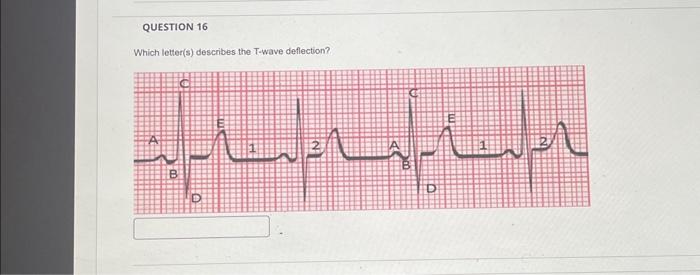 Solved Which letter(s) describes the T-wave deflection? | Chegg.com