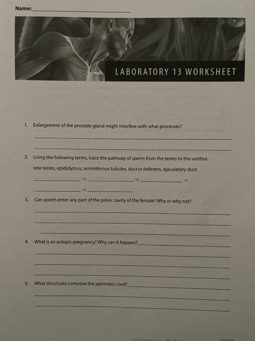 Solved Name: LABORATORY 13 WORKSHEET 1. Enlargement of the | Chegg.com