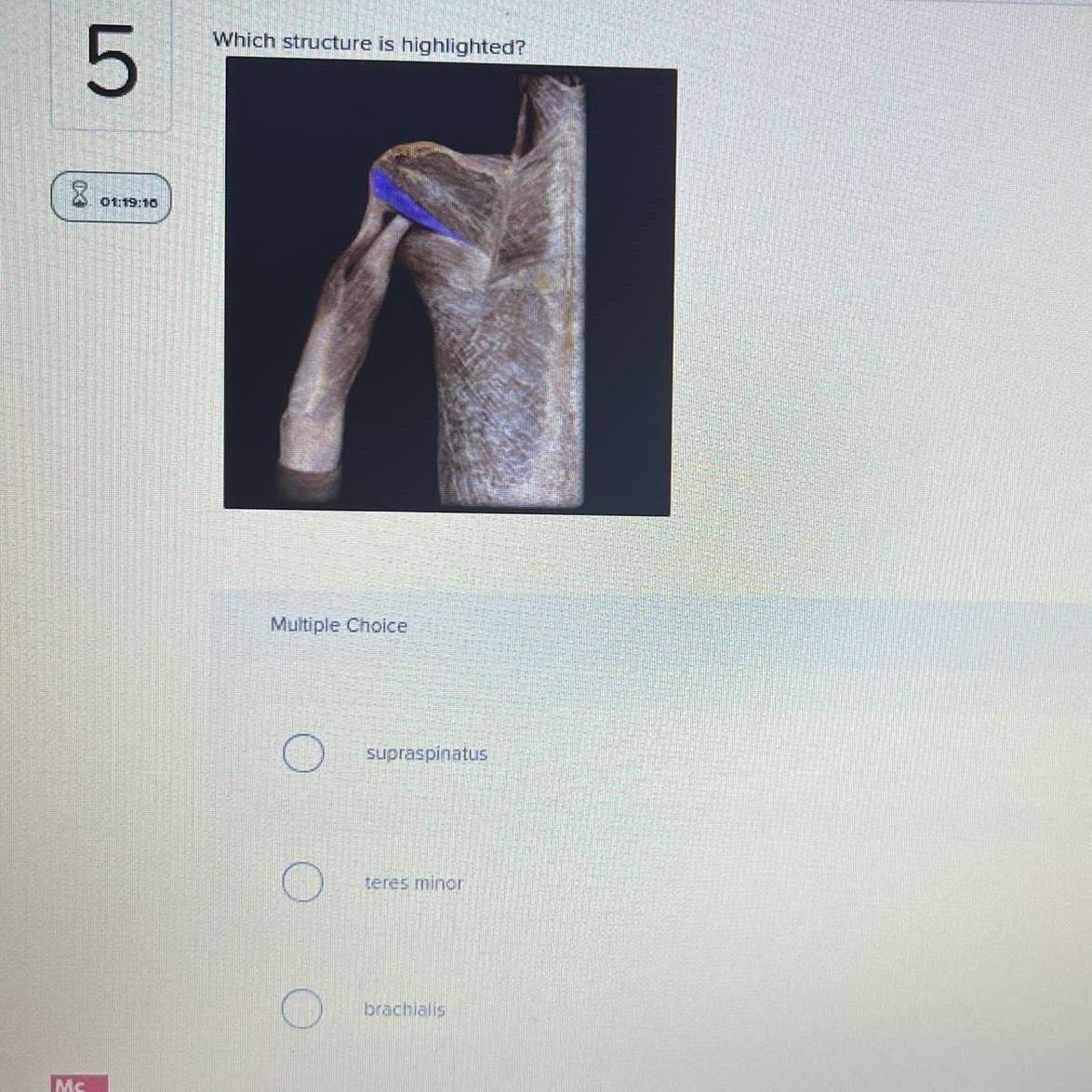 Solved Which structure is highlighted?01:19:10Multiple | Chegg.com