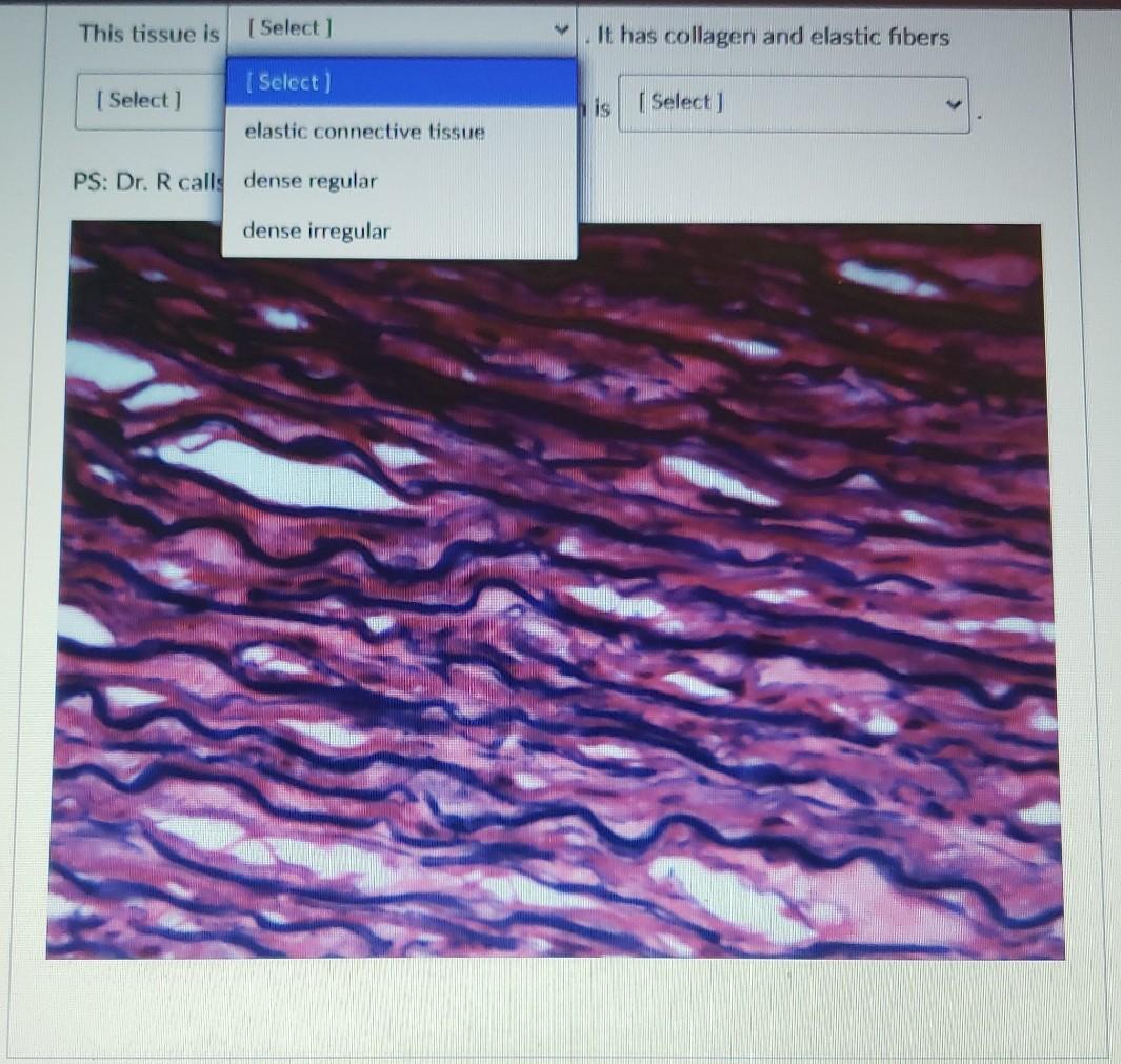 Elastic Connective Tissue Aorta