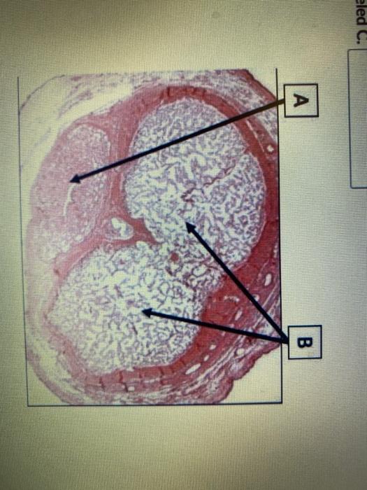 Solved 97. Identify the lumen within the structure labeled | Chegg.com