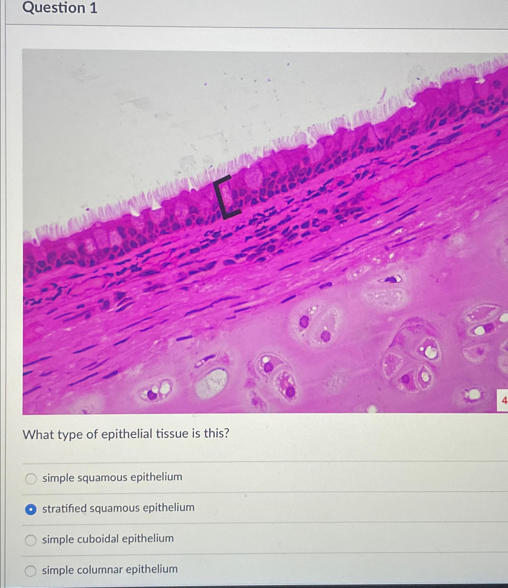 Solved Question 1What type of epithelial tissue is | Chegg.com