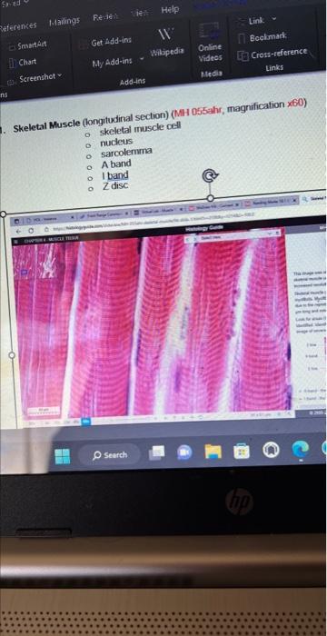 Skeletal Muscle (longitudinal section) (MH 055ahr, | Chegg.com