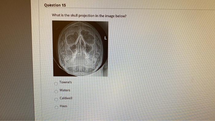 Solved Question 15 What is the skull projection in the image | Chegg.com