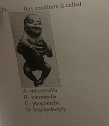 Solved 39. this condition is called A micromelia B. | Chegg.com