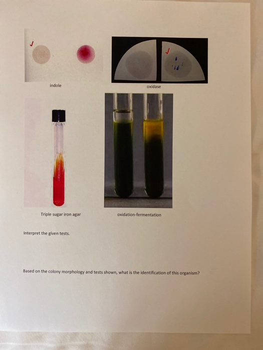 Solved indole Oxidase Triple sugar iron agar | Chegg.com