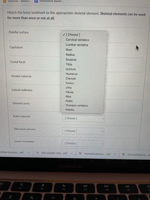 Solved Match the bony landmark to the appropriate skeletal | Chegg.com