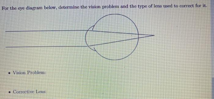 Solved For the eye diagram below, determine the vision | Chegg.com