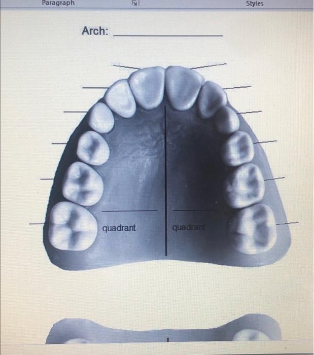 number each tooth eg 26, 55 not name Be aware this | Chegg.com