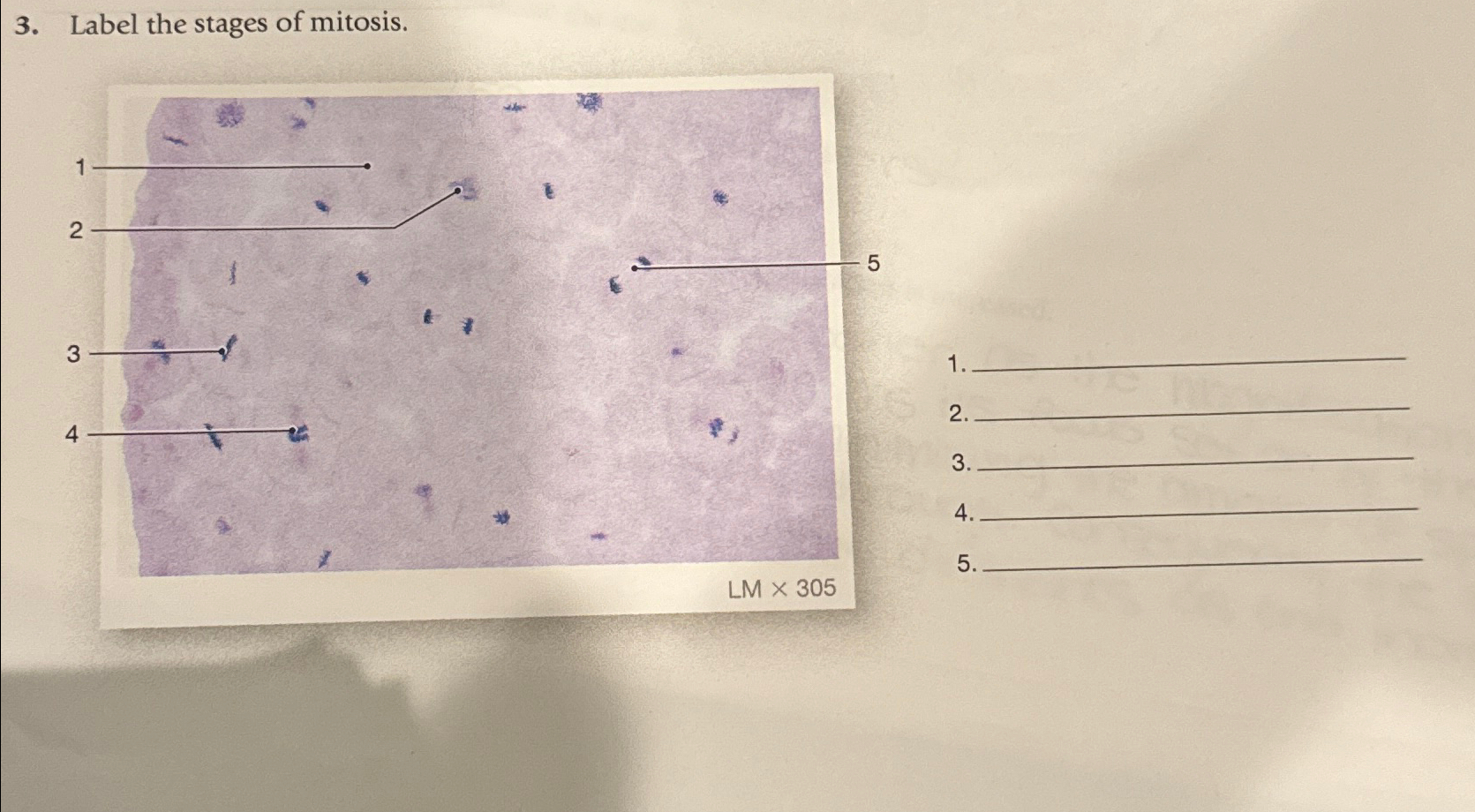 Solved Label the stages of mitosis. | Chegg.com