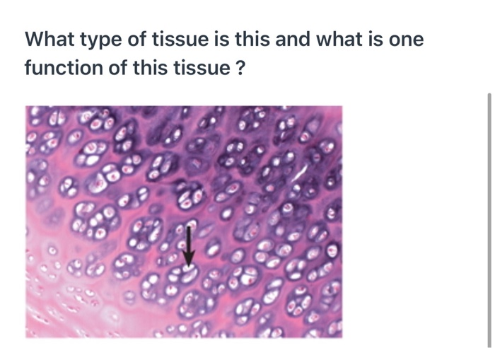 Solved What type of tissue is this and what is one function | Chegg.com