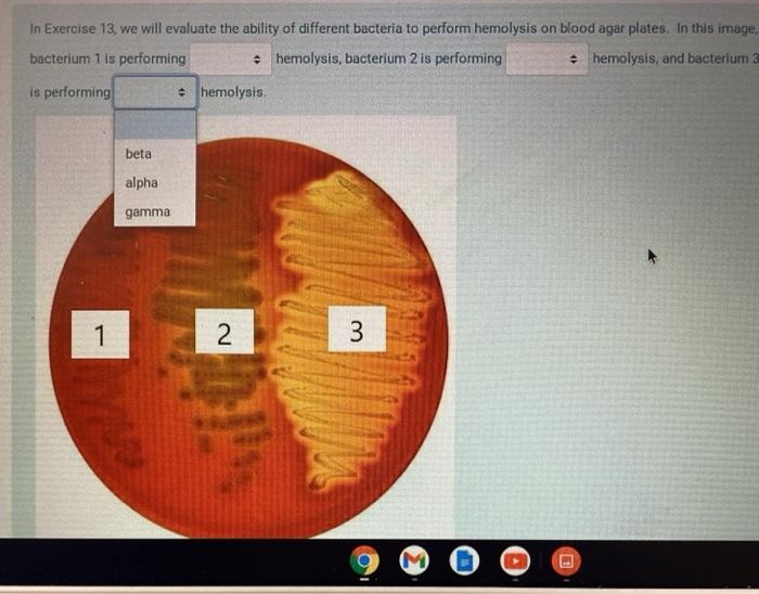 Solved Only salt-tolerant bacteria can grow on MSA (Mannitol | Chegg.com