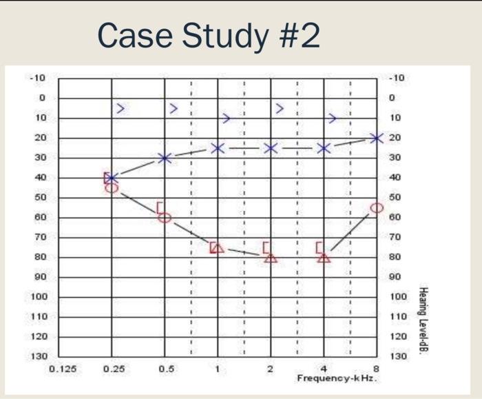 Solved interpret each audiogram. for each case, are | Chegg.com