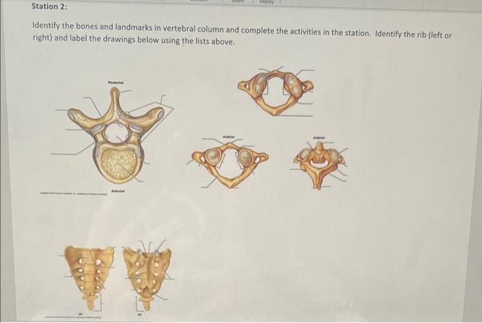 Solved Station 2:Identify the bones and landmarks in | Chegg.com