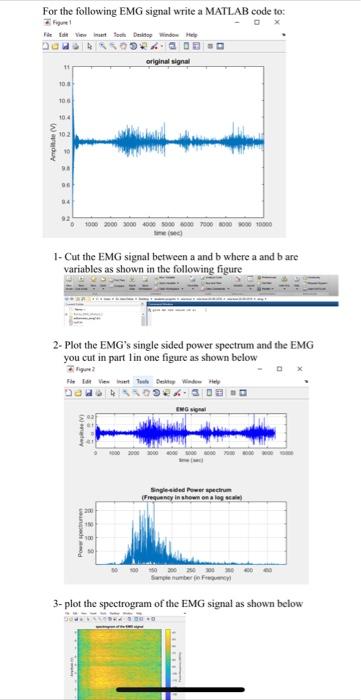 For The Following Emg Signal Write A Matlab Code To