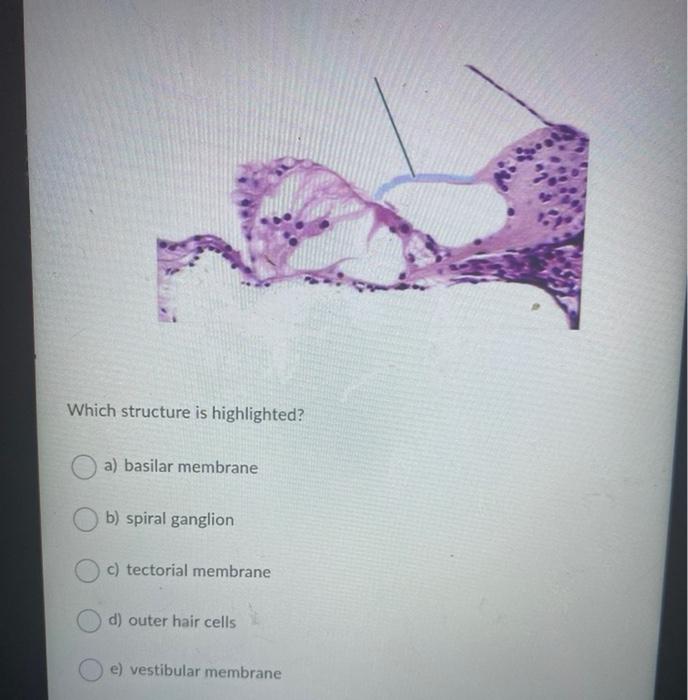 Solved Which structure is highlighted? a) basilar membrane | Chegg.com
