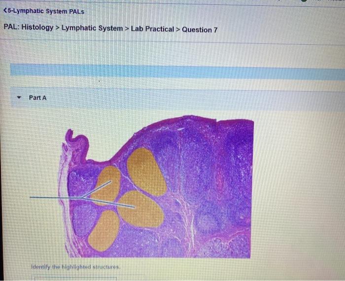 Solved Lymphatic | Chegg.com