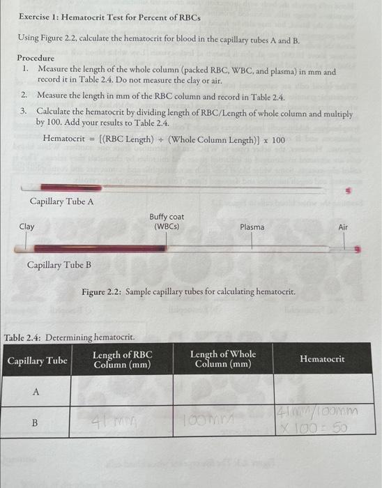 Solved Exercise 1: Hematocrit Test for Percent of RBCs Using | Chegg.com