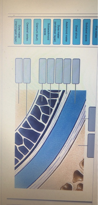 Solved abeling Activity: Brain, Cranium, and Meninges (Dural | Chegg.com