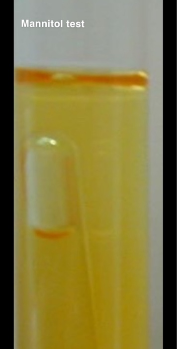 Solved This is unknown gram negative bacteria. A glucose | Chegg.com