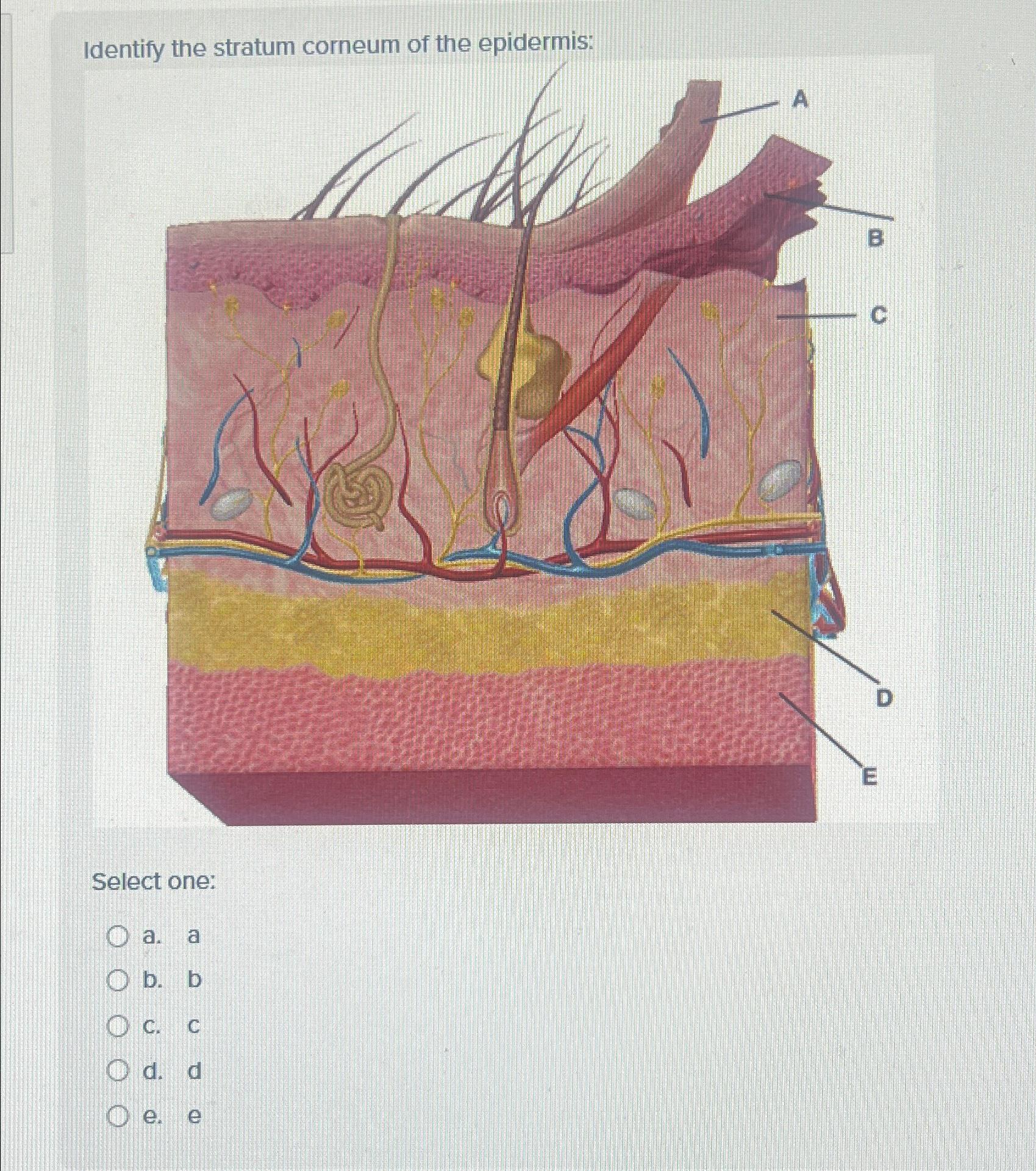 Solved Identify the stratum corneum of the epidermis:Select | Chegg.com