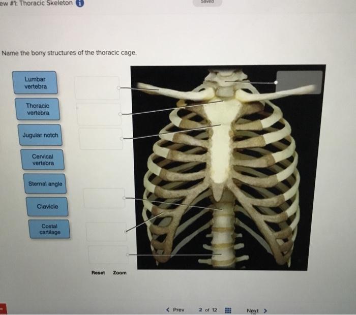 Solved Saved ew #1: Thoracic Skeleton Name the bony | Chegg.com