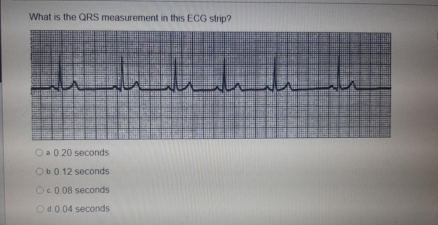 Solved What is the QRS measurement in this ECG strip? w O a. | Chegg.com