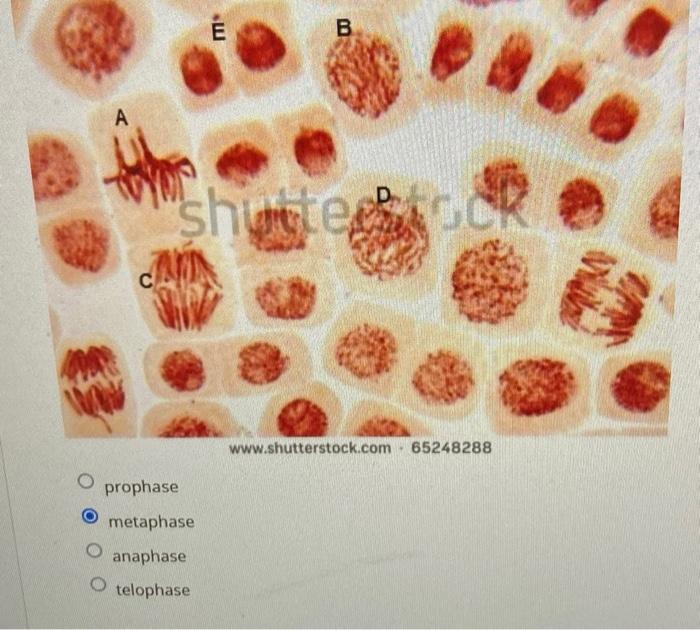 www.shutterstock.com - 65248288 prophase metaphase | Chegg.com