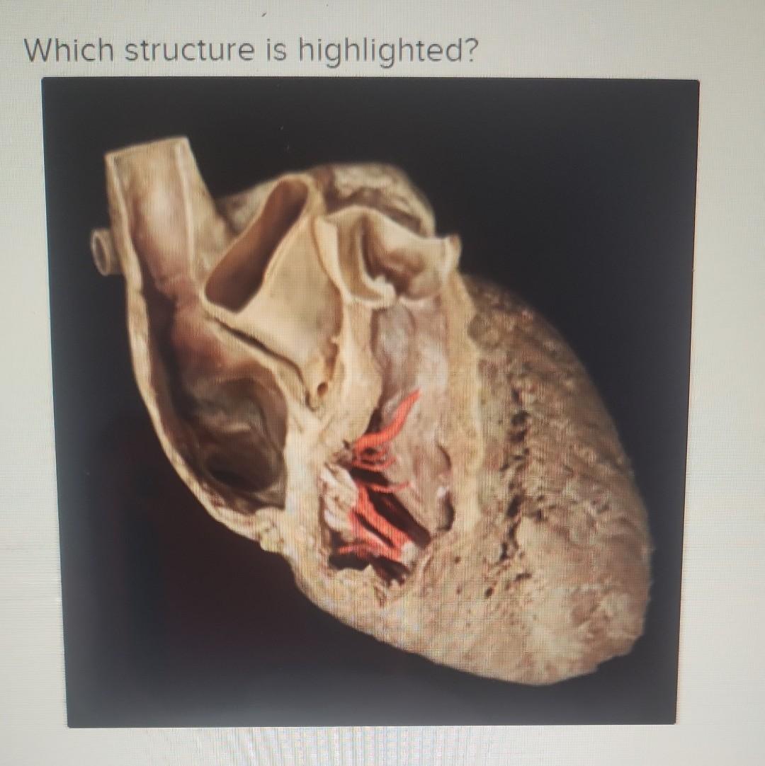 Solved Which structure is highlighted? | Chegg.com