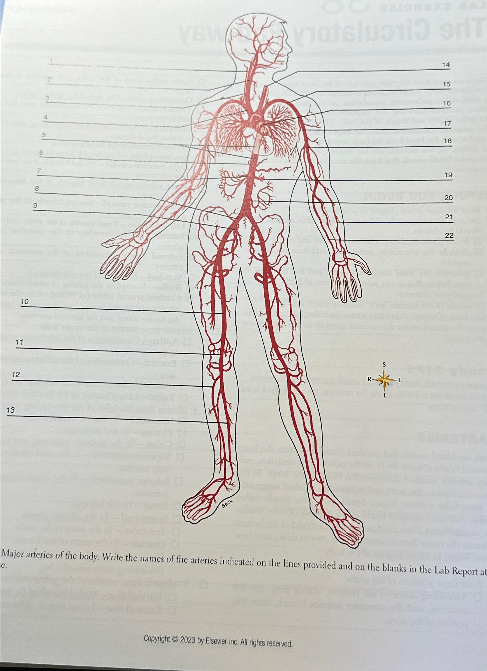 Solved Major arteries of the body. Write the names of the | Chegg.com
