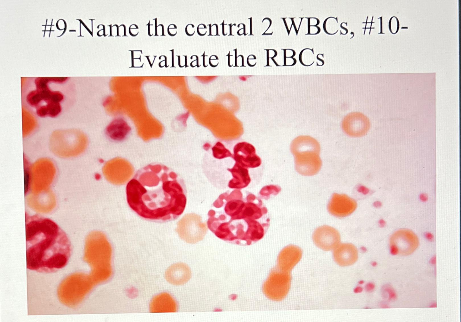Solved #9-Name the central 2 ﻿WBCs, ﻿#10Evaluate the RBCs | Chegg.com