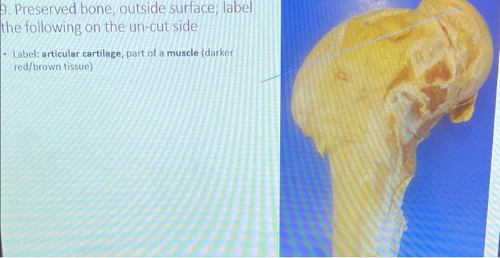 Solved 9. Preserved bone, outside surface; label the | Chegg.com