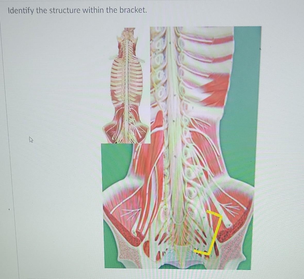 Solved Identify the structure at the tip of the | Chegg.com