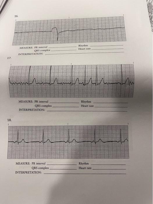 Solved MEASURE: PR interval Rhyrhm QRS complex Heart rate | Chegg.com