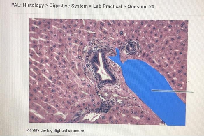 Solved PAL: Histology > Digestive System > Lab Practical > | Chegg.com