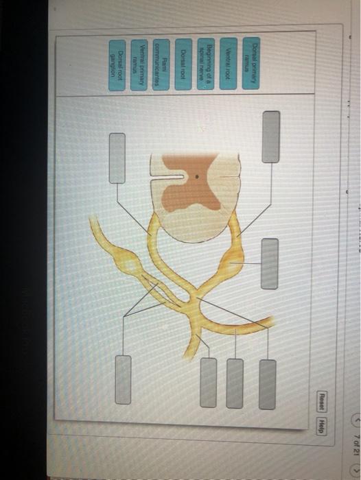Solved 7 of 21 Resot Help Dorsal primary ramus TOO Ventral | Chegg.com