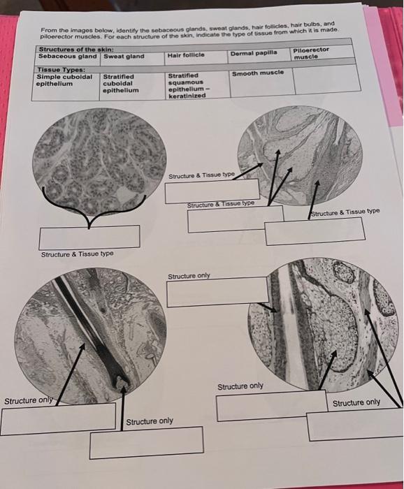 Solved From the images below, identify the sebaceous glands, | Chegg.com